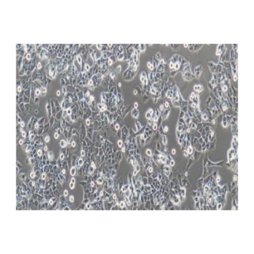 Human Highly Metastatic HCC Cell Line, #MHCC-97H