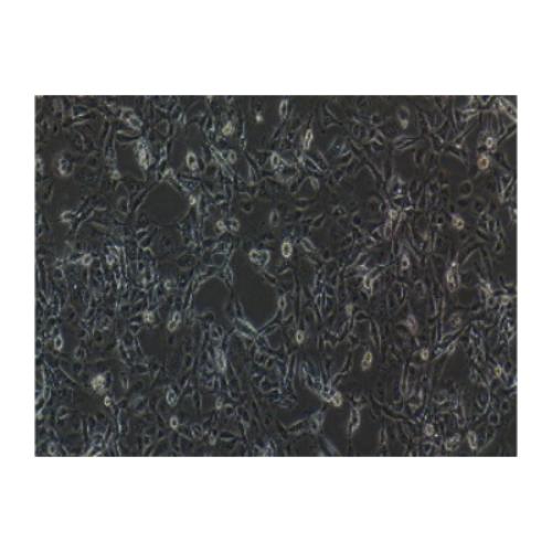 Human Membrane Mesothelial Cell Line, #MET-5A