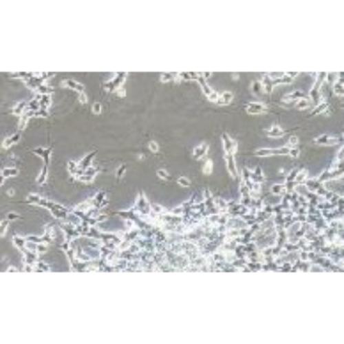 Human Neuroblastoma Cell Line, #SH-SY5Y