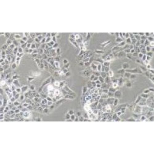 Human Tongue Scale Cancer Cell Line, #CAL-27