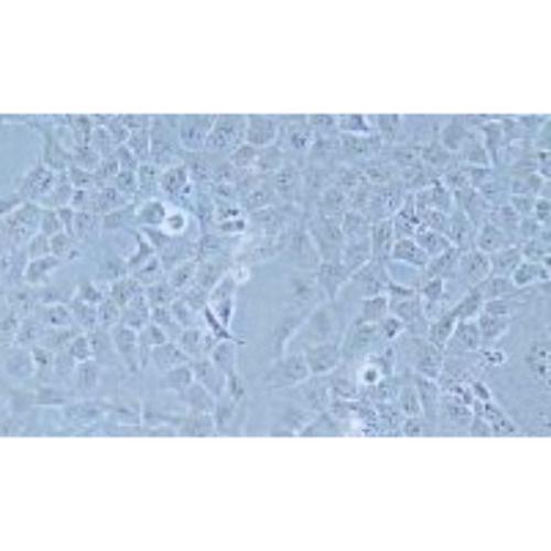 Human Chorionic Trophoblast Cell Line, #HTR-8/SVNEO