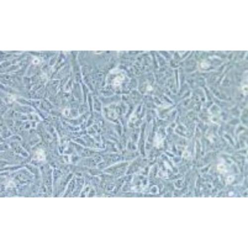 Neuroblastoma Cell Line In The Human Brain, #SK-N-AS
