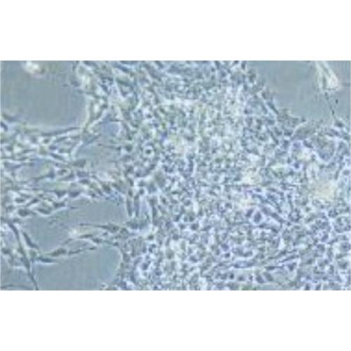Human Neuroblastoma Cell Line, #SK-N-DZ